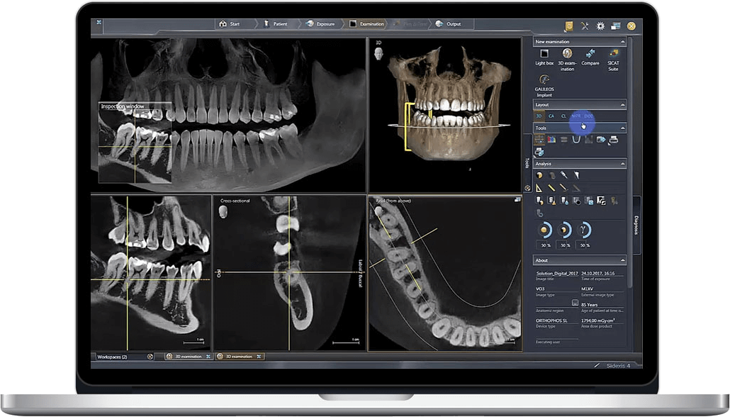 Best CBCT Scan in Varanasi | Cone Beam Computed Tomography